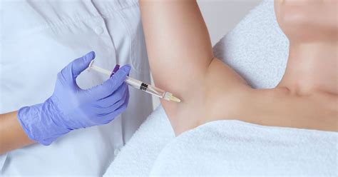 Underarm Botox Injections And Common Questions Answered پیکاپ سرمایه
