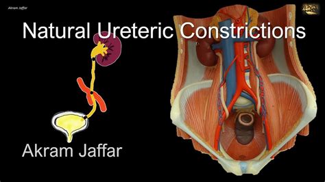 Ureter Anatomy Key Sites Of Narrowing And Potential Stone Impactions