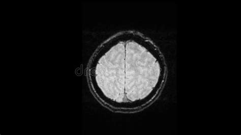 Mri Brain Scan Magnetic Resonance Image Ct Scan Of Human Brain In