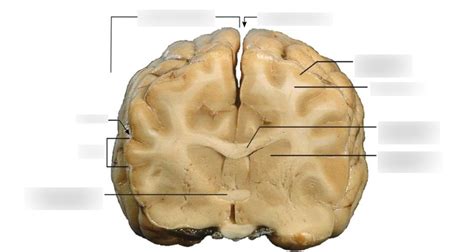 Transverse Section Of Brain Anatomy Diagram Quizlet