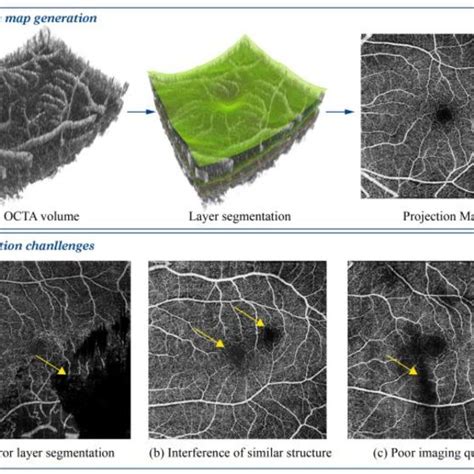 The Generation Of Projection Map And The Challenges In The Rv Download Scientific Diagram