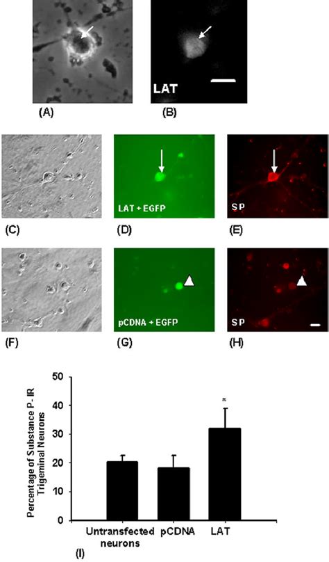 Figure 1 From Herpes Simplex Virus Type 1 Latency Associated Transcript Induced Immunoreactivity