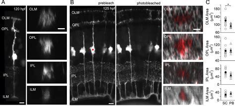 Structure Of Outer Plexiform Layer Of Retina Semantic Scholar