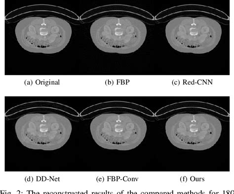 Figure 2 From A Deep Network For Sinogram And Ct Image Reconstruction