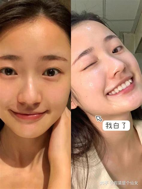 为什么皮肤学博士强烈建议你冬季皮肤干燥暗黄，要通过补充胶原蛋白来调理？ 知乎