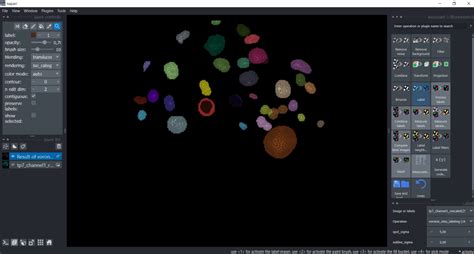 Quality Assurance Of Segmentation Results Focalplane