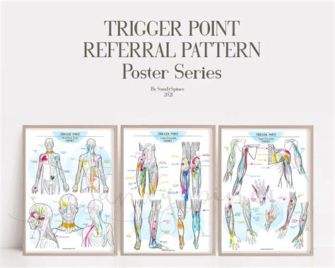 Muscle Trigger Point Charts Set Of 3 Art For Etsy