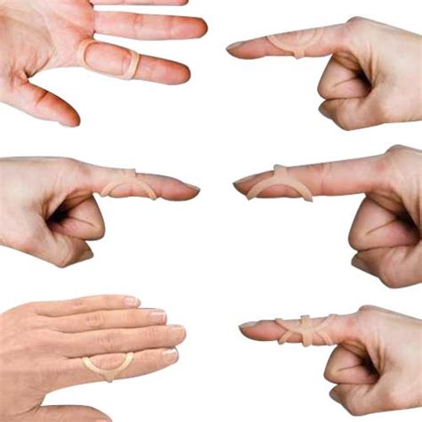 Hypermobility And Ehlers Danlos Syndrome What I Wish Everyone Understood Corn Allergy Girl