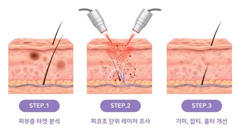 피코토닝 연세리움의원