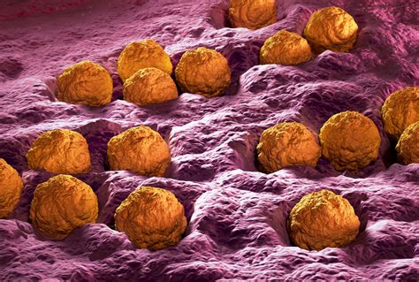 Ružienka Alebo Rubeola Týždeň Prevencie