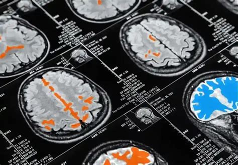 Accurate Data Labeling And Data Annotation Services For Ai And Ml Models