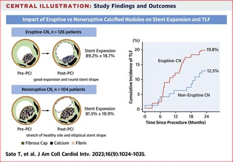 Jacc Cardiovascular Interventions Vol 16 No 9