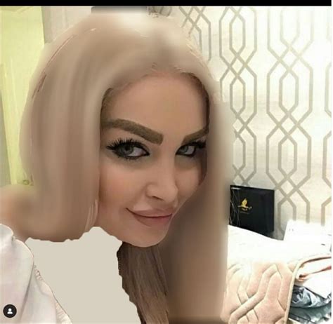 عکس همسر عروسکی فرزاد فرزین صورتی پر از عمل و ژل