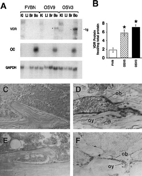 OSVDR Transgene Expression Increases Osteoblastic VDR Levels A The