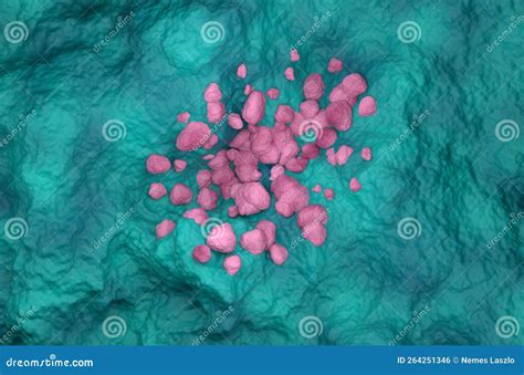 Sclc Stock Illustrations 17 Sclc Stock Illustrations Vectors And Clipart Dreamstime