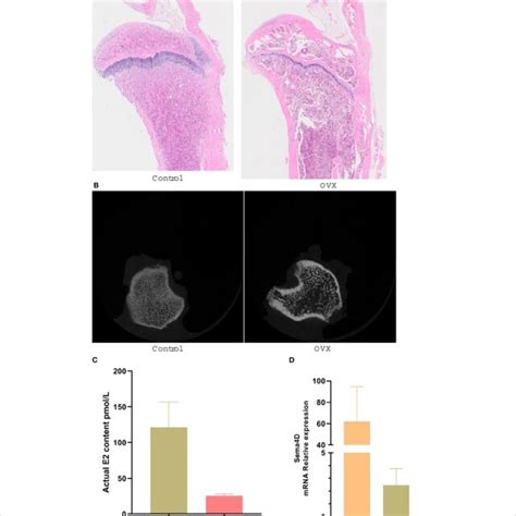Trabecular Bone Microstructure Values For Each Cohort Download Scientific Diagram
