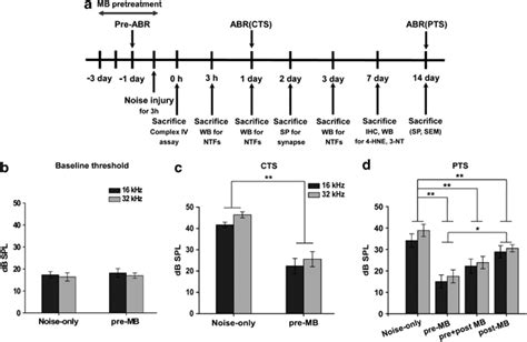Abr Threshold Shift After Noise Exposure A Experimental Timeline For