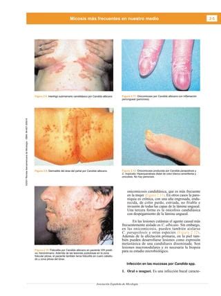 Guia Práctica De Micología Clínica Pdf
