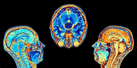 Et Si Le Cerveau Avait Bien Un Sexe