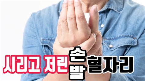 손ㆍ발ㆍ손가락ㆍ발가락까지 저리고 시리고 마비 증상 그대로 두면 위험 즉시 해결하는 혈자리 Youtube