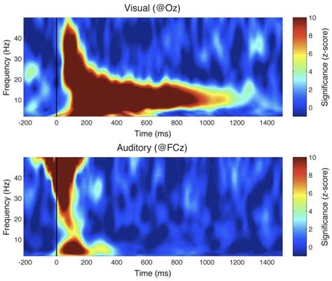 The Wavelet Based Time Frequency Analysis Results Are Plotted For