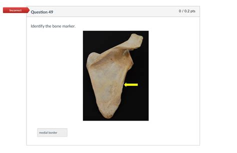 Solved Identify The Bone Marker I Tried Lateral Axillary