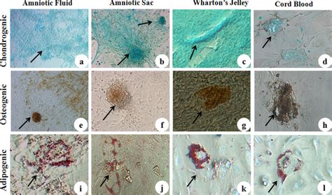 Amniotic Fluid Under Microscope