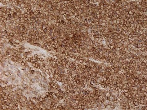 Antigen Retrieval Hier Solution 10x 100 Ml Ab208572 Abcam