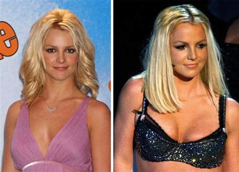 Funny Pictures Amazing Picture Before And After Boob Jobs