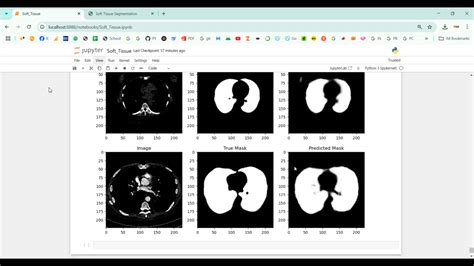 Soft Tissue Segmentation Using Image Dataset In Python Projects