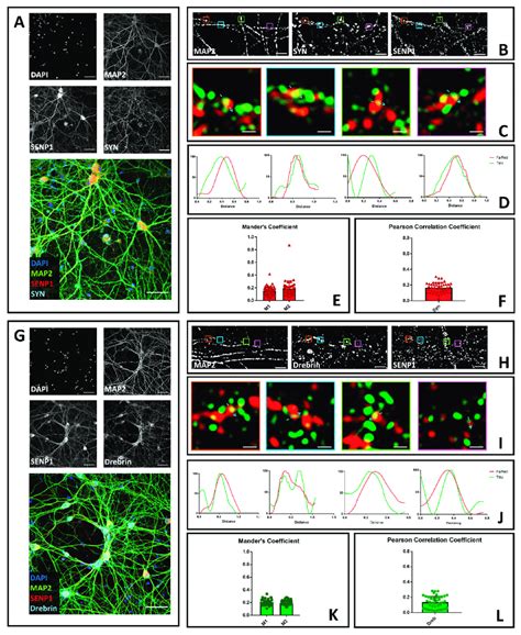 Confocal And Structured Illumination Microscopy Sim Microscopy To