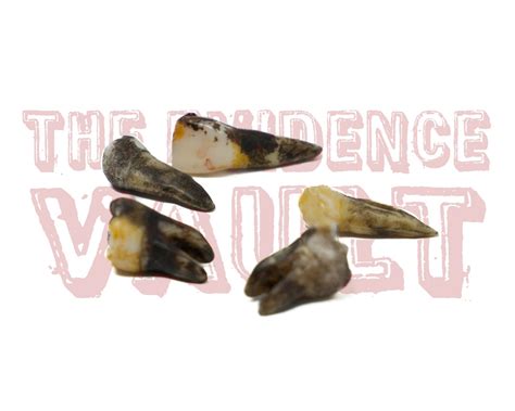 Halloween Ii 1981 Ben Tramer Teeth Burn Victim Fake Teeth Etsy