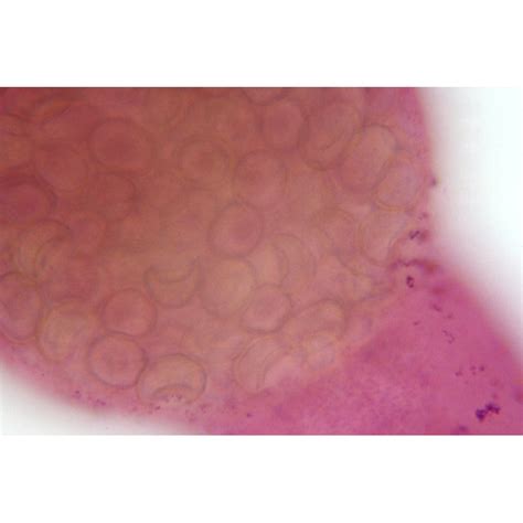 Echinococcus Granulosus Adult W M Medical And Science Media