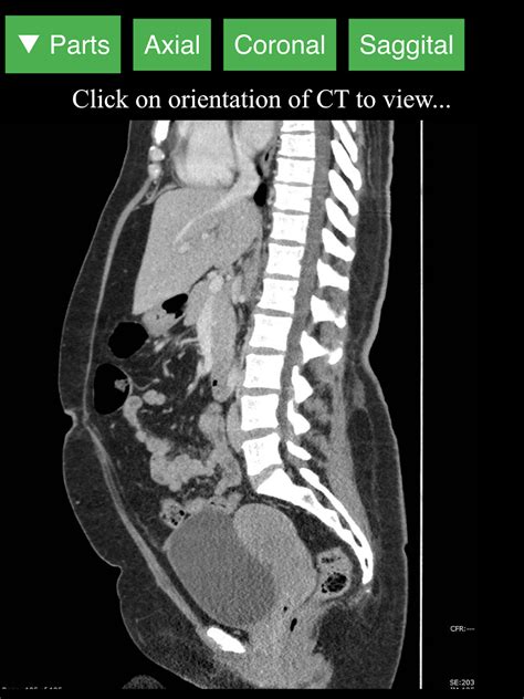 Android 용 Radiology Ct Viewer Apk 다운로드