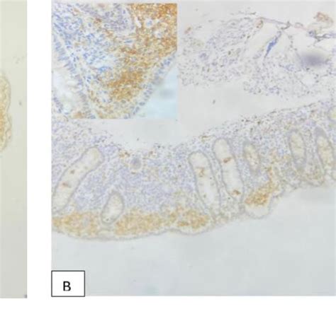 Immunohistochemical Staining Download Scientific Diagram