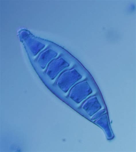 Macroconidium Of Microsporum Canis This Species Is The Main Causal Download Scientific Diagram