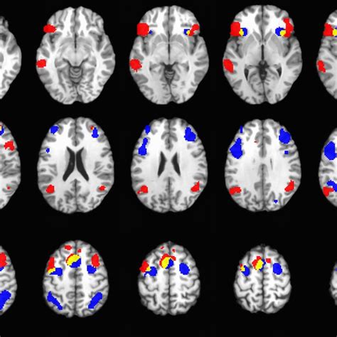 Projection Specific Excitation Of Bla Terminals In The Cea Induces Download Scientific Diagram