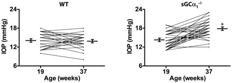 IOP Measured Serially At Time Points And Weeks In Eyes Download Scientific