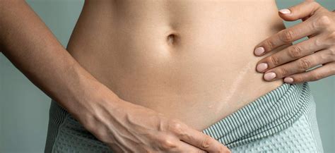 Comprehensive Guide To Appendectomy What You Need To Know