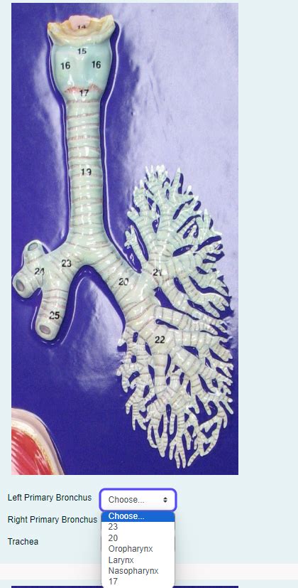 Solved Left Primary Bronchus Right Primary Bronchus
