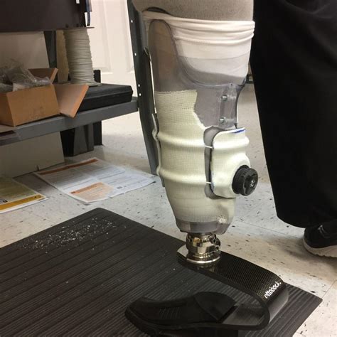 Prosthetics And Orthotics Solutions Adjustable Prosthetic Socket