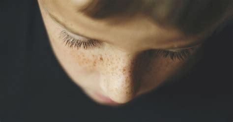 What Are Freckles Plus When To See Your Doctor