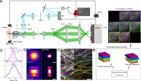Figure 1 From Fast Volumetric Multifocus Structured Illumination Microscopy Of Subcellular