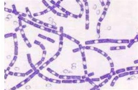 Gram Positive Bacilli Flashcards Quizlet