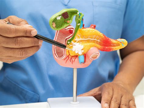 Early Signs Of Pancreatic Cancer