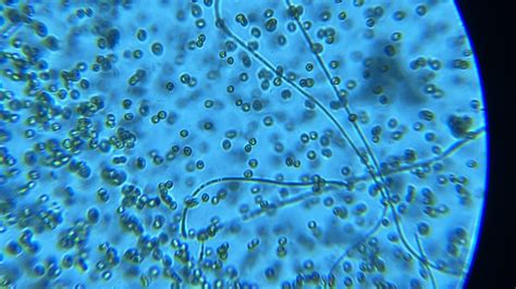 Are These Dinoflagellates Microscope Images Reef2reef