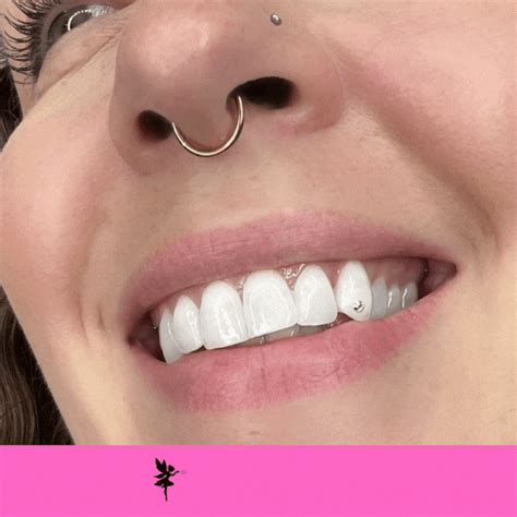 Blissful Smile Dental Hygiene Expert Oral Care In Blackfalds Ab