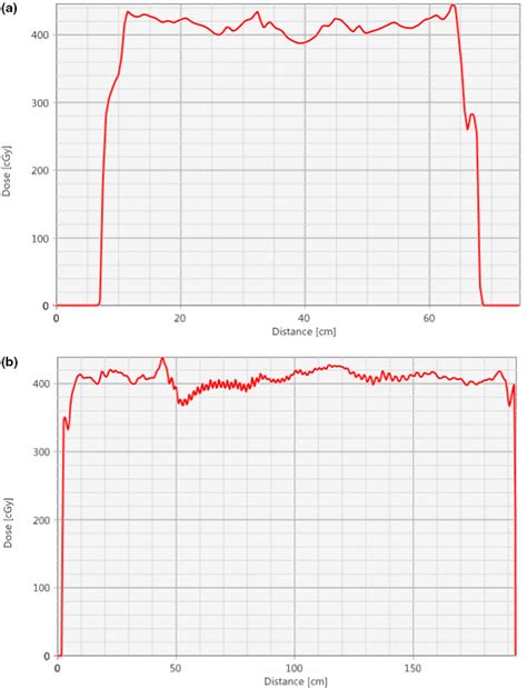 A Dose Profile Across The Chest As Indicated In Fig 5a B Dose Download Scientific Diagram