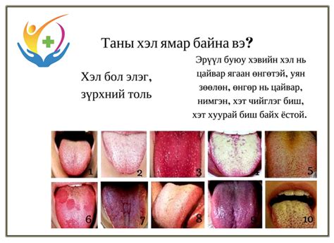 Хэл бол эрүүл мэндийн толь Хүний Гэгээн Ар Үр Эмнэлэг