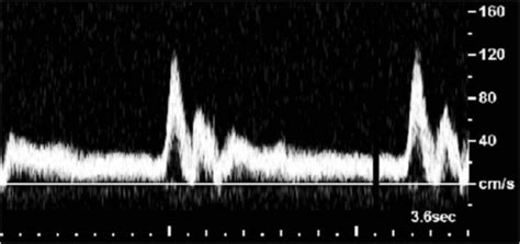 SPI Flashcards Quizlet